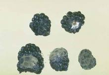 Blackberry (Rubus spp.)-Fruit Rot | Pacific Northwest Pest Management ...